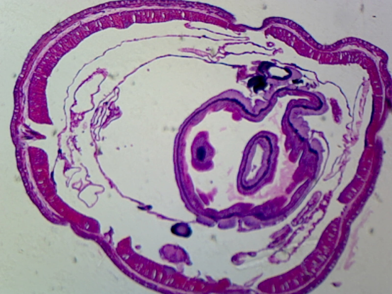 Earthworm Setae; Cross Section; M Stain by Go Science Crazy - Walmart.com