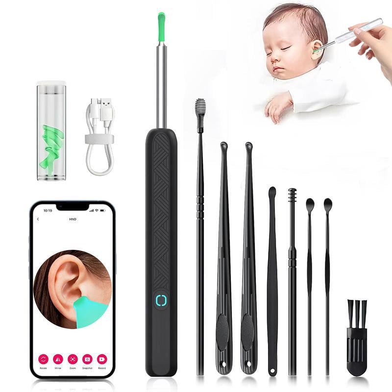 Earwax Removal Tool Set with Camera - Portable 360° Wide Angle Ear ...
