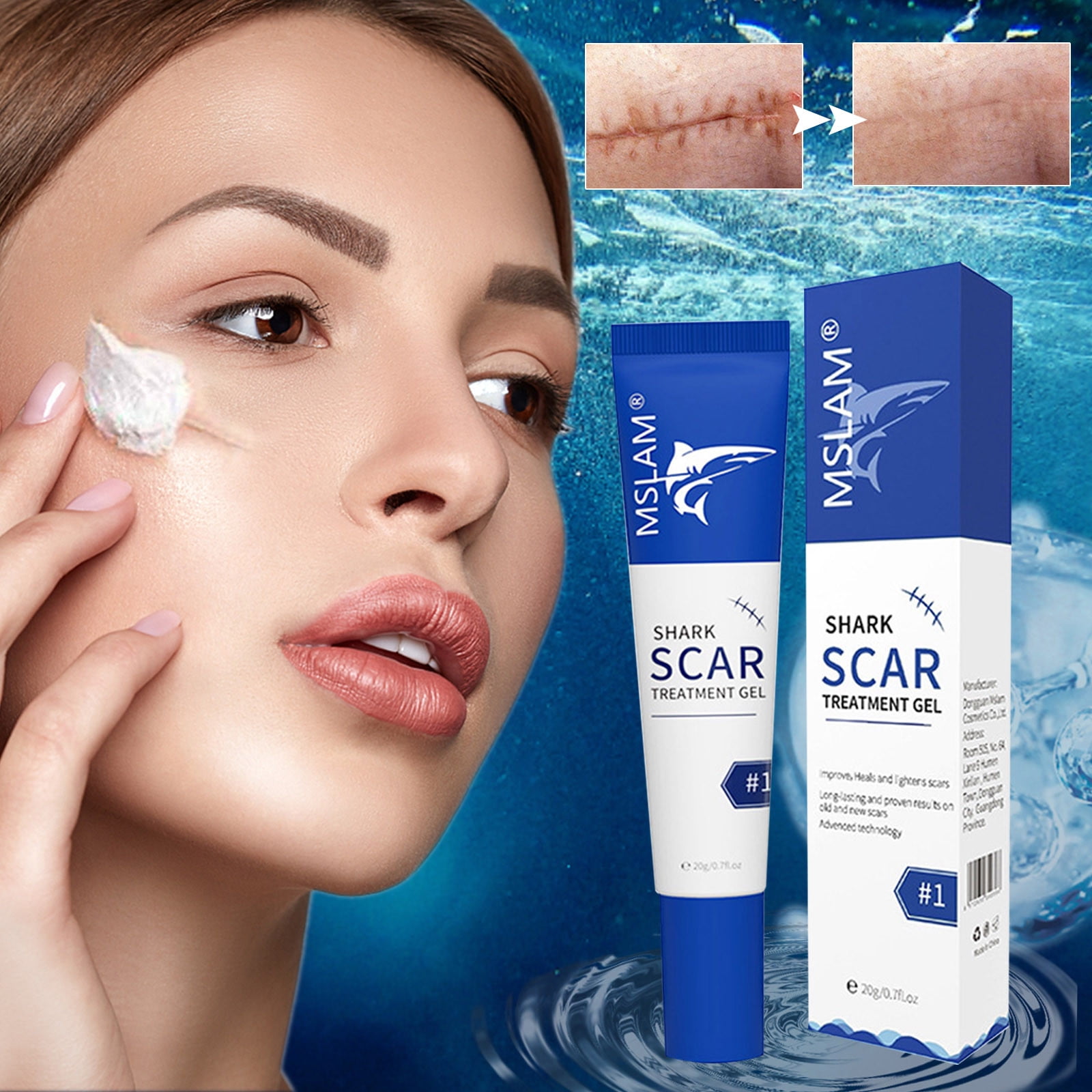 Easter Clearance Body Care Scar Removal Proliferation Scar Gel Scar ...
