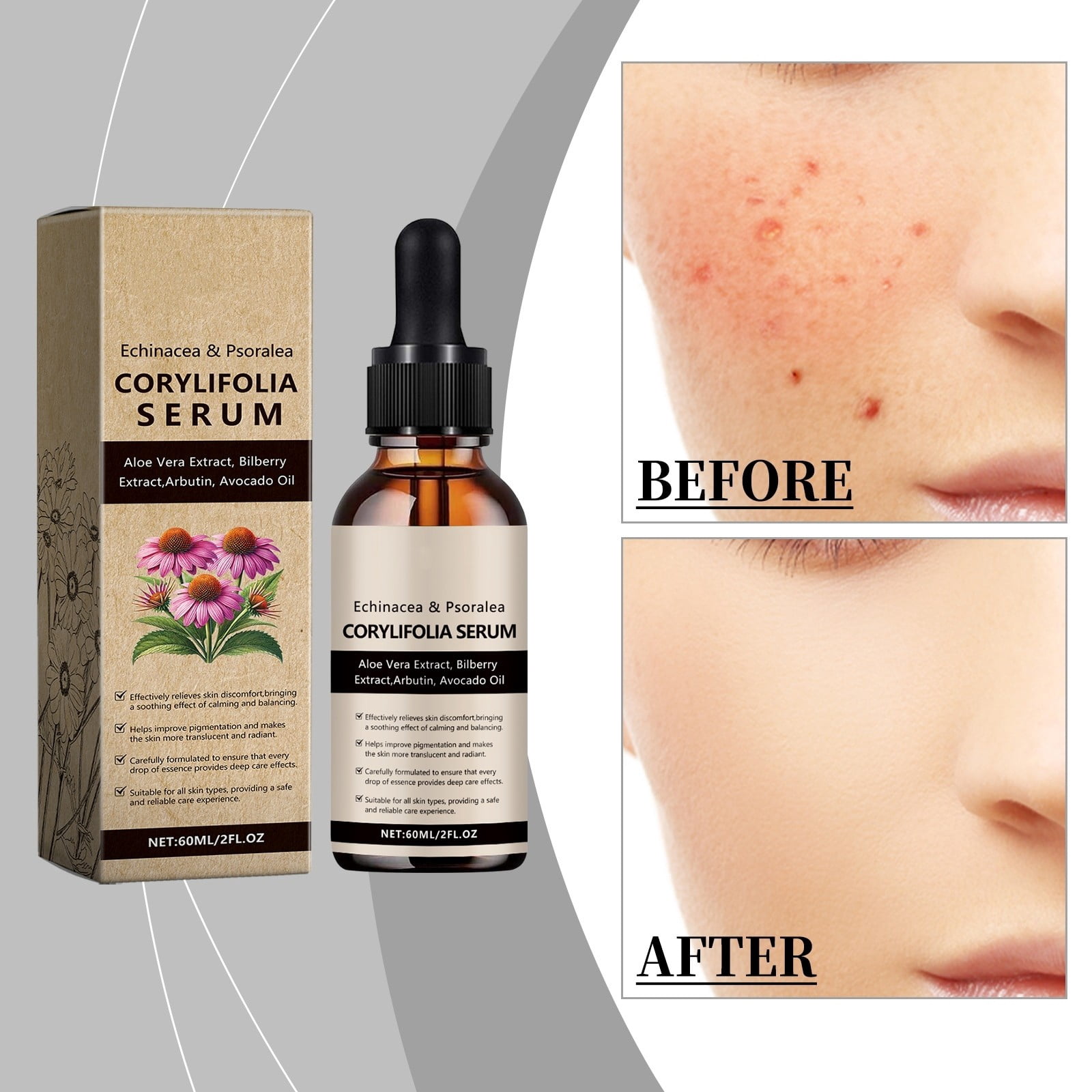 Echinacea Skin Soothing And Soothes Skin Discomfort And Improves . Deep ...