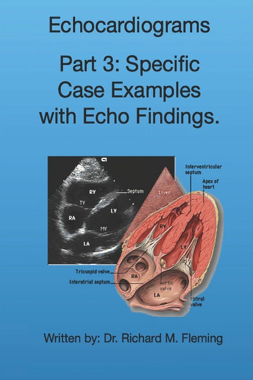 Echocardiograms - Part 3: Specific Case Examples with Echo Findings ...