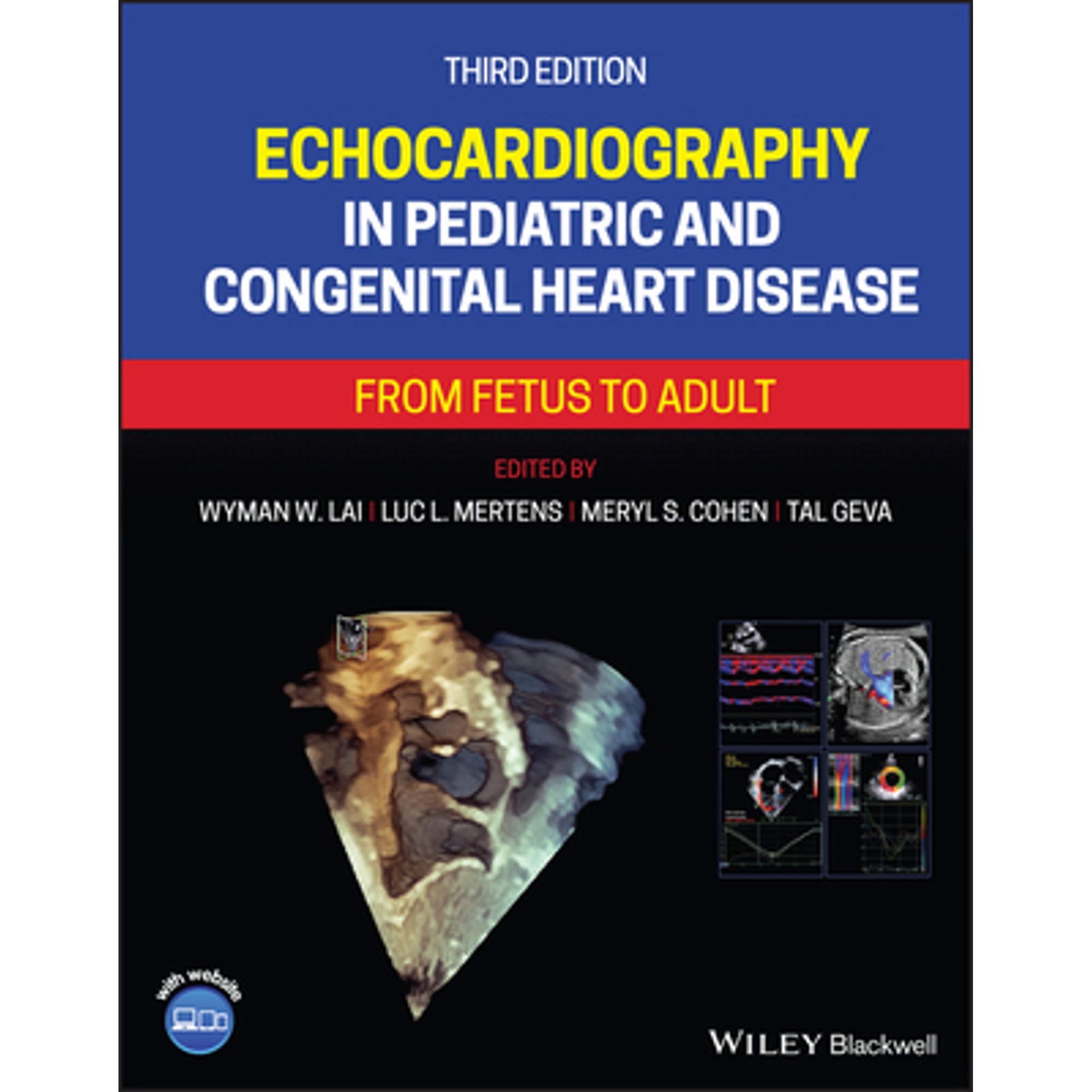 Pre-Owned Echocardiography in Pediatric and Congenital Heart Disease ...