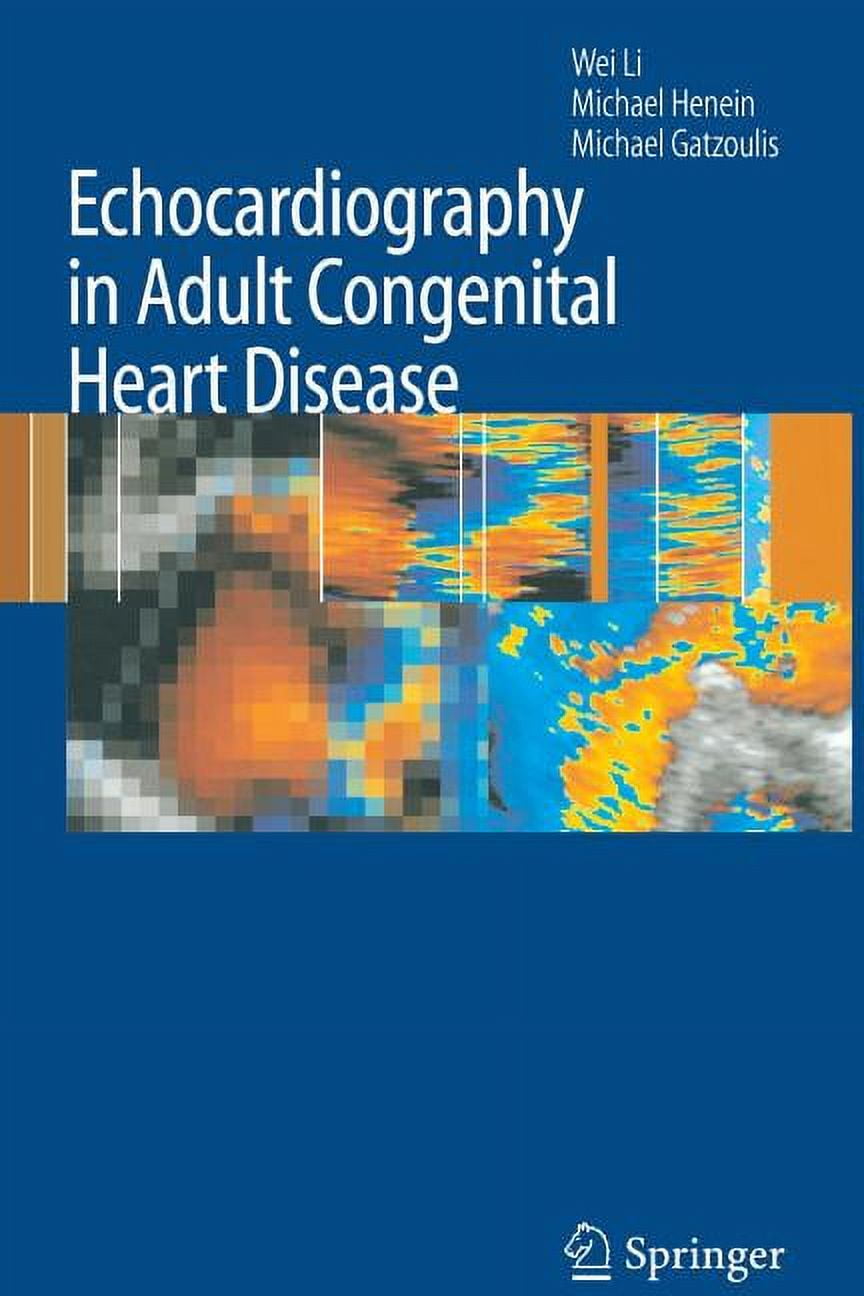 Echocardiography in Adult Congenital Heart Disease, (Paperback ...