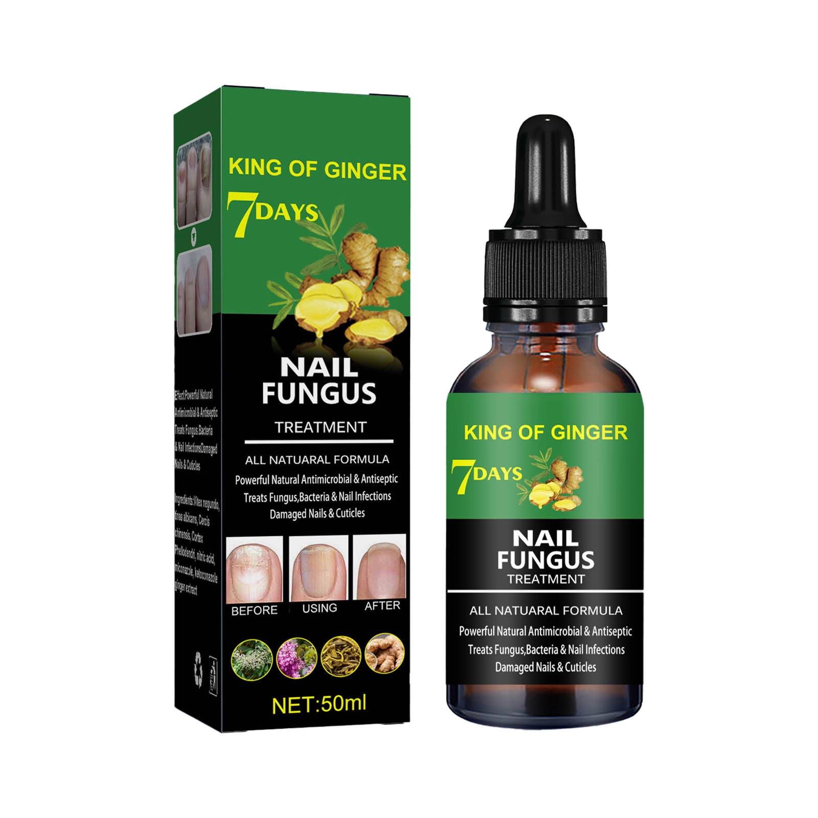 EcoVerve King Of Ginger Nail Fungus Treatment,Treats Fungus,Bactria ...