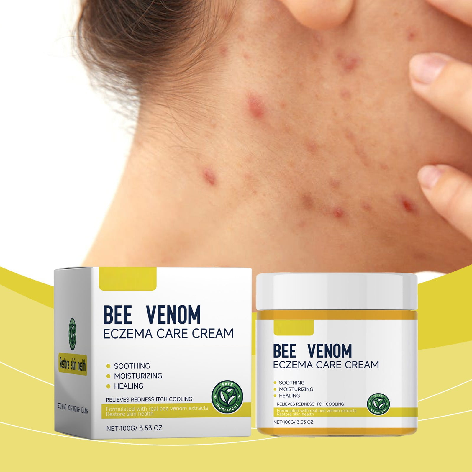 Eczema Anti Itch Cream For Dry Skin Rosacea Face Rash Cream Itch Redness Relief For Dermatitis