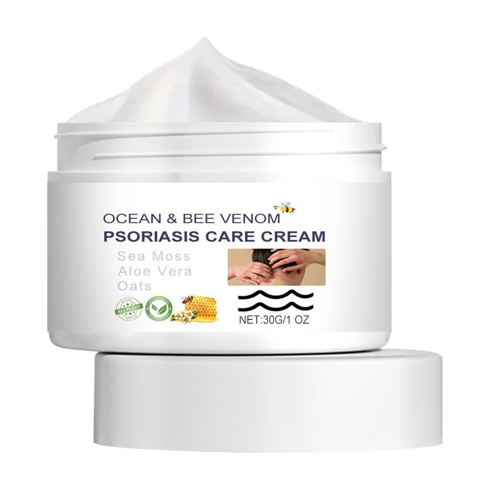 Eczema Anti-itch Cream For Dry Skin-Rosacea Face Rash Cream-Itch ...