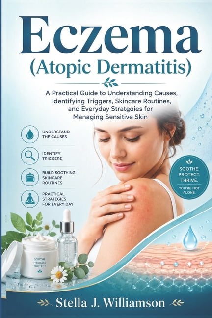 Eczema (Atopic Dermatitis): A Practical Guide to Understanding Causes ...
