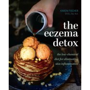 Eczema Detox : The Ultimate Guide on How to Cure Eczema Naturally ...