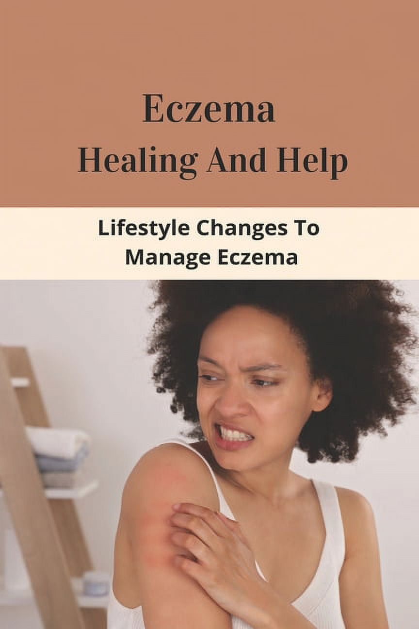 Eczema Healing And Help: Lifestyle Changes To Manage Eczema: What Foods ...