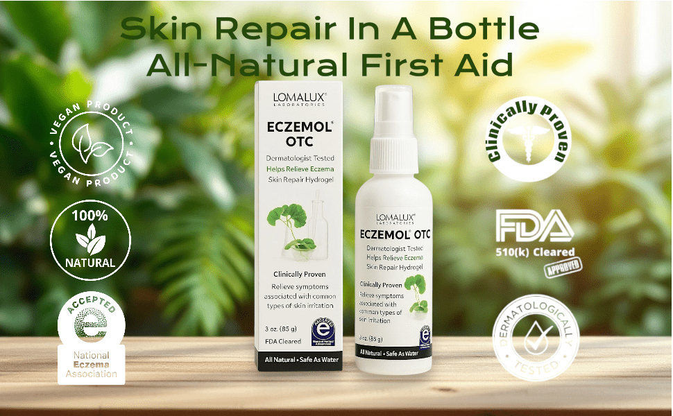 Eczemol OTC 2 fl. oz. - FDA Cleared Anti-Itch Spray for Eczema, Burns ...