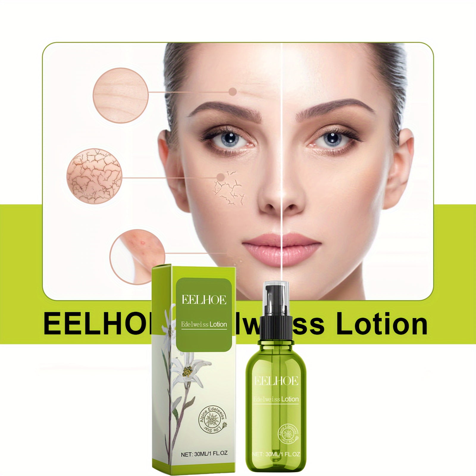 Edelweiss Lotion, Moisturizing And Brightening Face Lotion Contains ...