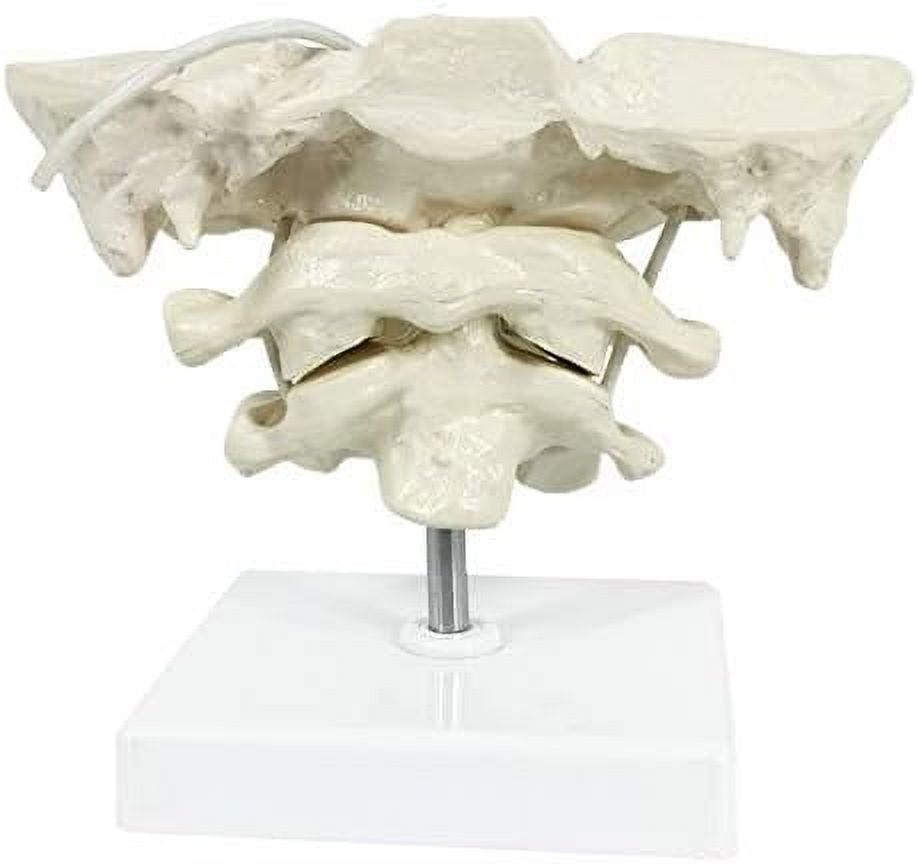 Educational Model Occiput Model - Human Cervical Spine Model Occipital ...