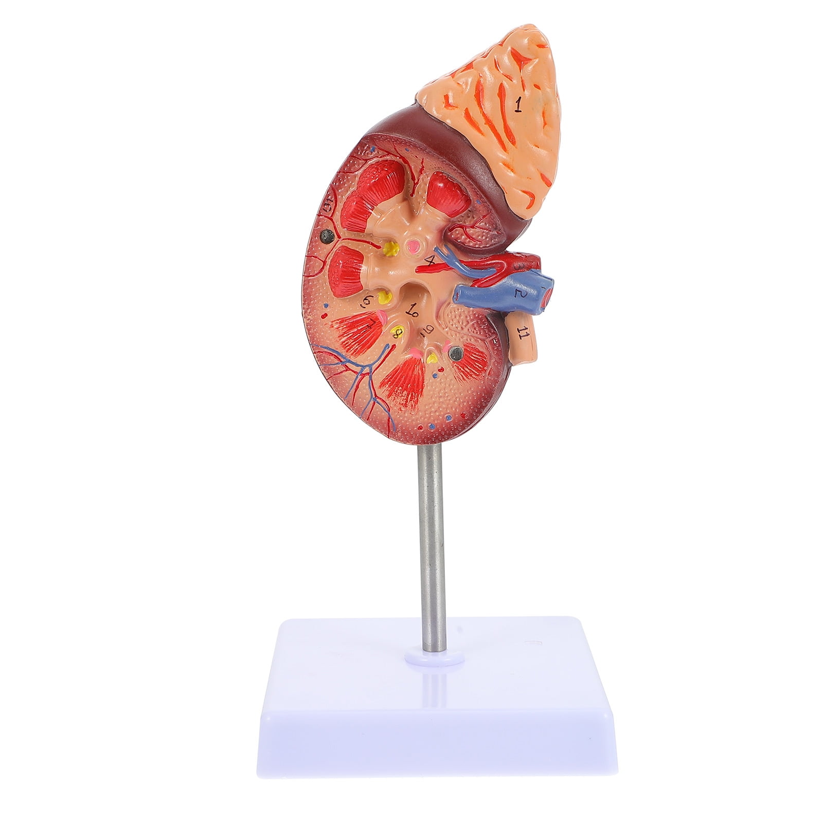 Eease Human Kidney Prop Anatomical Model Biology Class Accessory Kidney ...