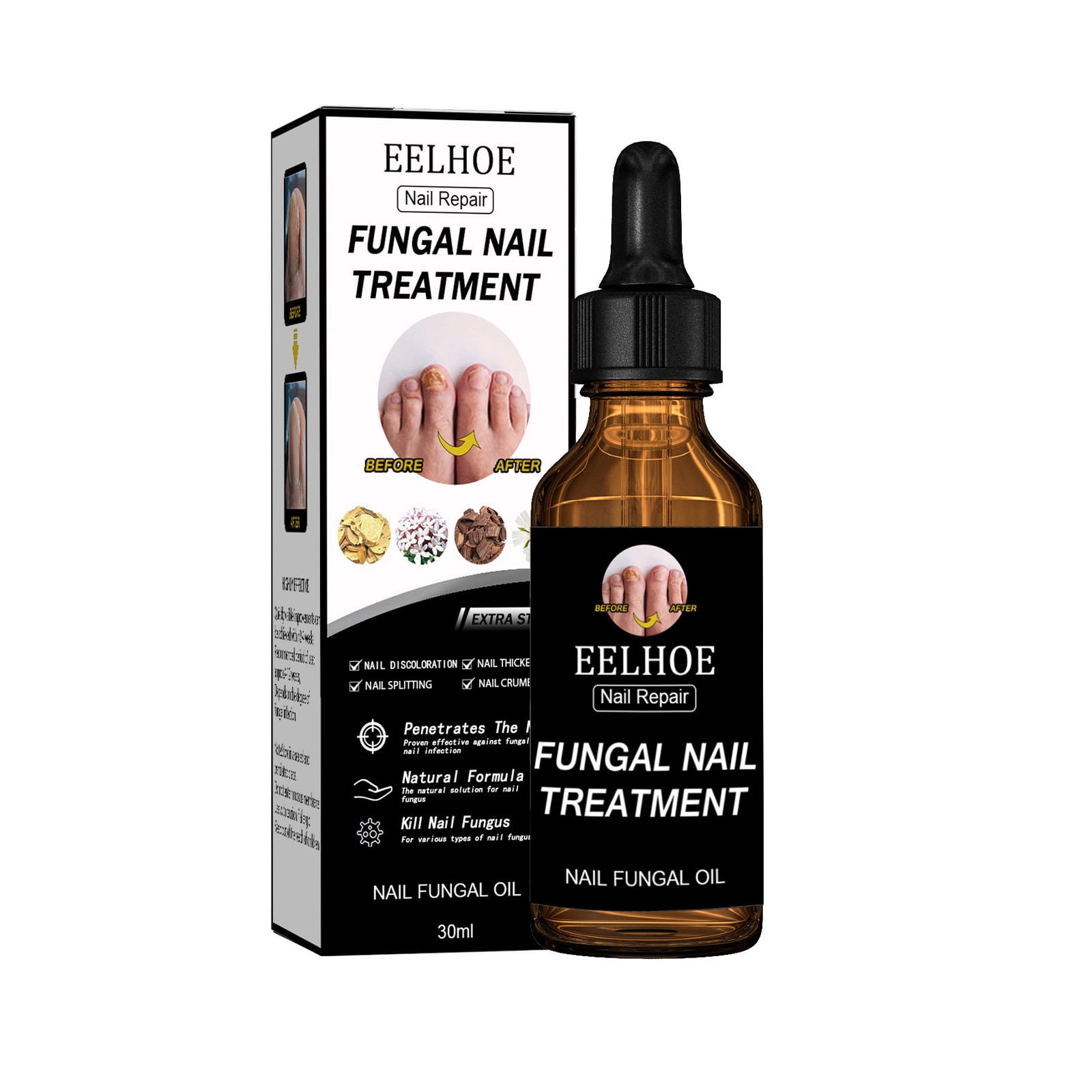 Eelhoe Nail Repair Brightening Nail Nutrient Solution Thickening ...