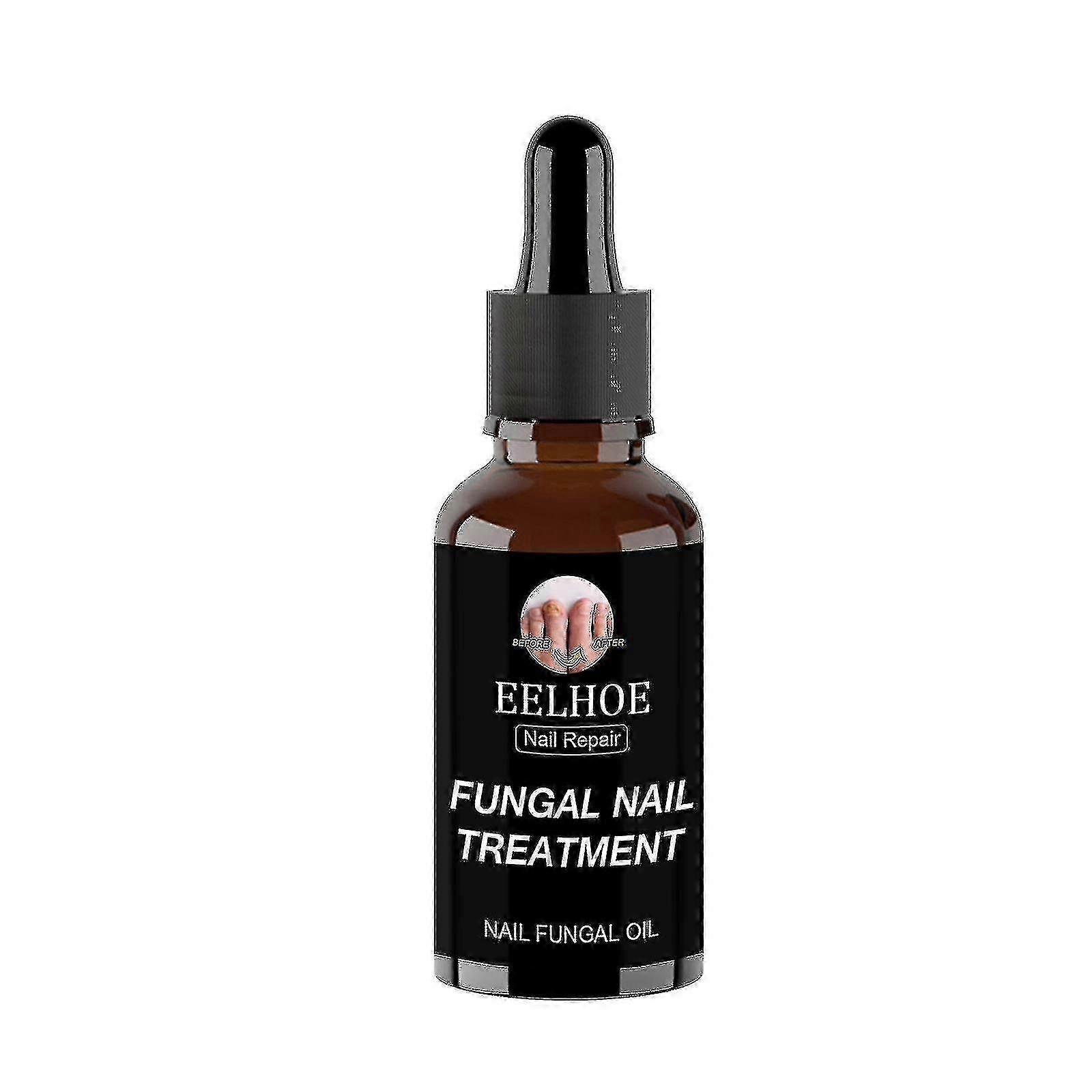 Eelhoe Powerful Nail Fungus Care Repair Liquid Professional Cuticle Oil ...