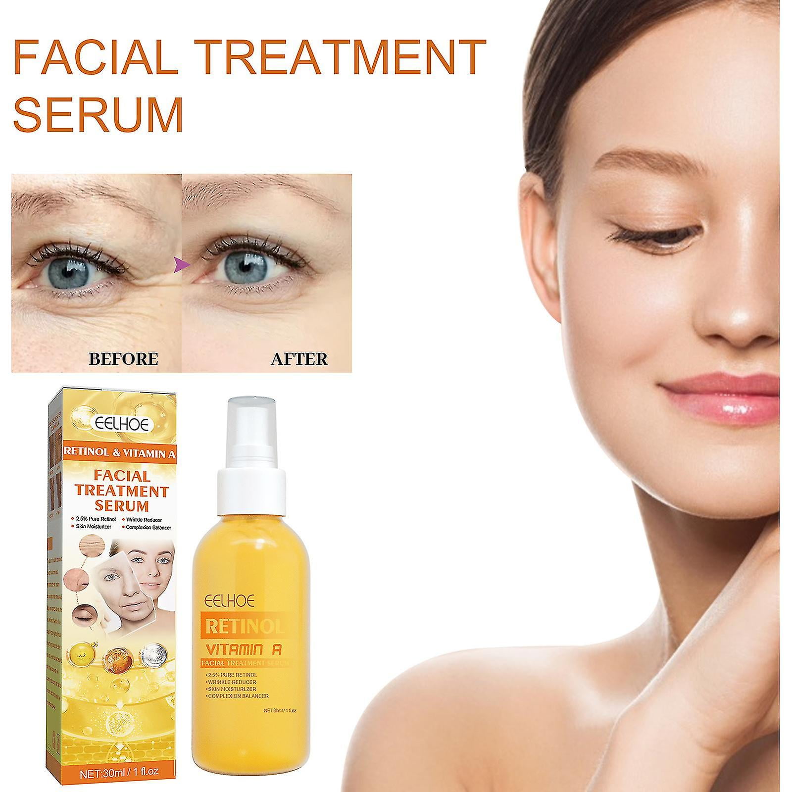 Eelhoe Retinol Anti-wrinkle Essence Spray Fades Fine Lines Around The ...