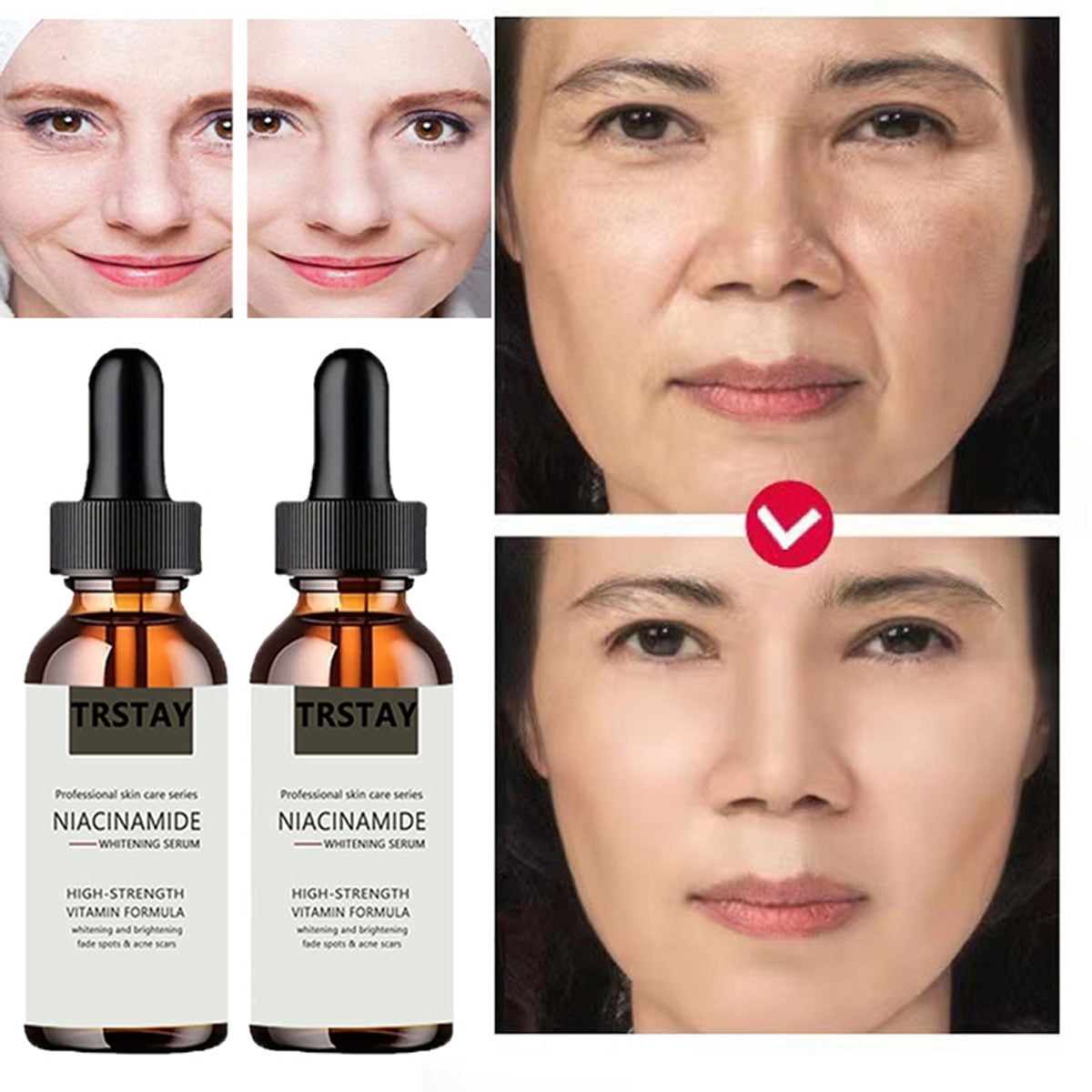 Effective Whitening Serum Remove Dark Spots Freckle Essence Anti-Aging ...