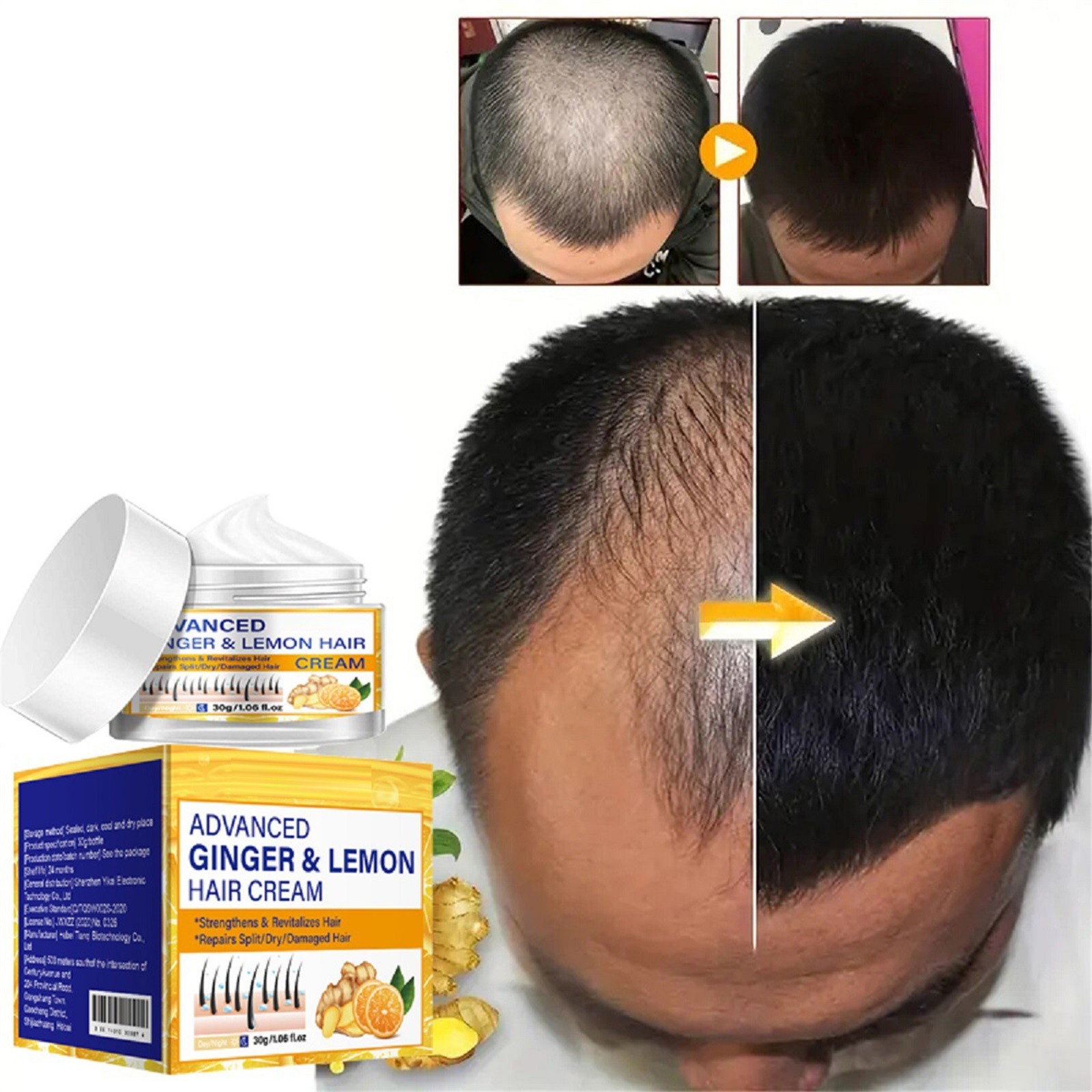 Eguobalx 30g Hair Growth Cream Anti-dandruff Healthy Plant Extracts ...