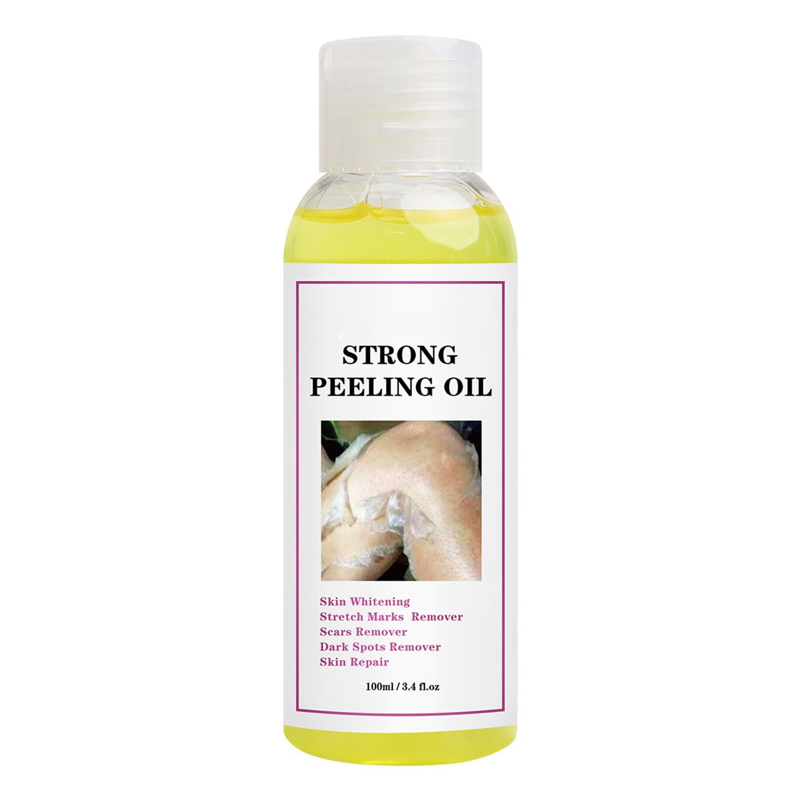 EiecJdf Body Care Peeling Oil For Dark Skin Yellow Peeling Oil Strong Peeling Oil Extra Strength ...