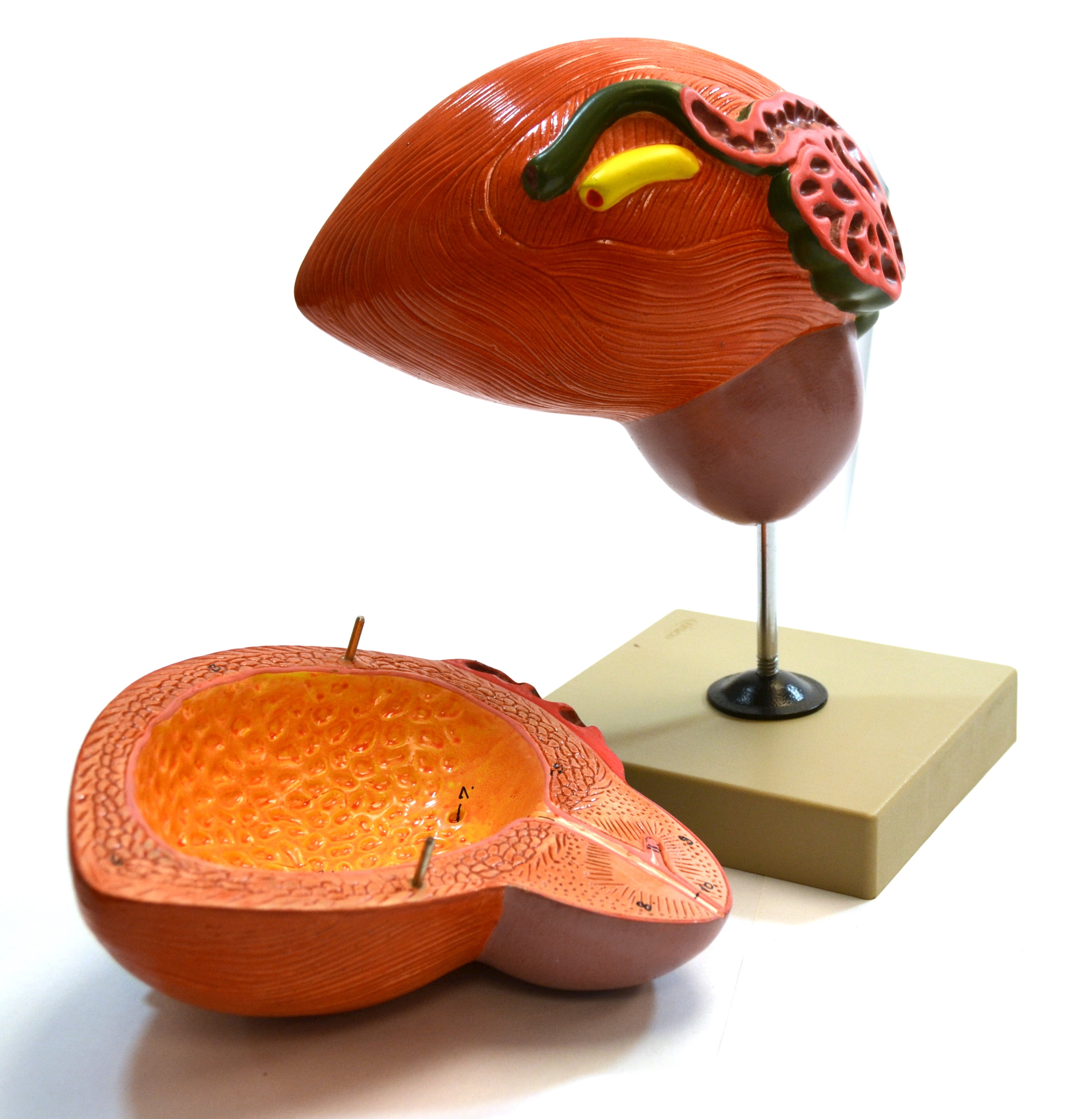 Eisco Labs Human Urinary Bladder with Prostate Anatomical Model, 2 ...
