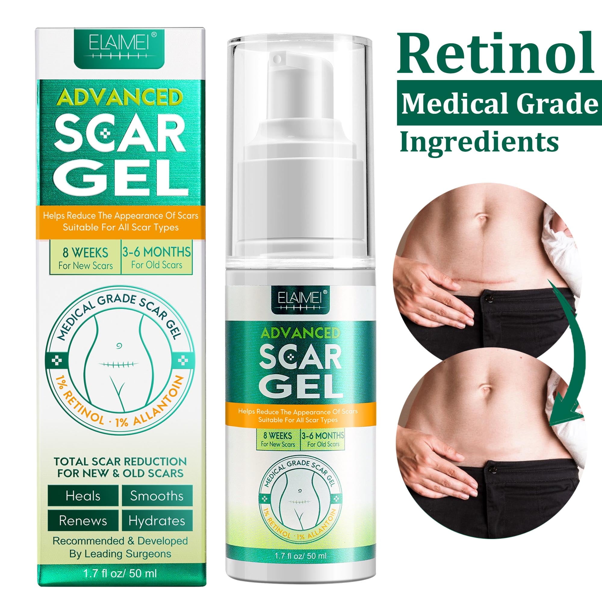 Elaimei Scar Gel Medical Grade 50ml/1.7floz, Scar Removal Treatment for Surgery,C-Section,Keloid ...