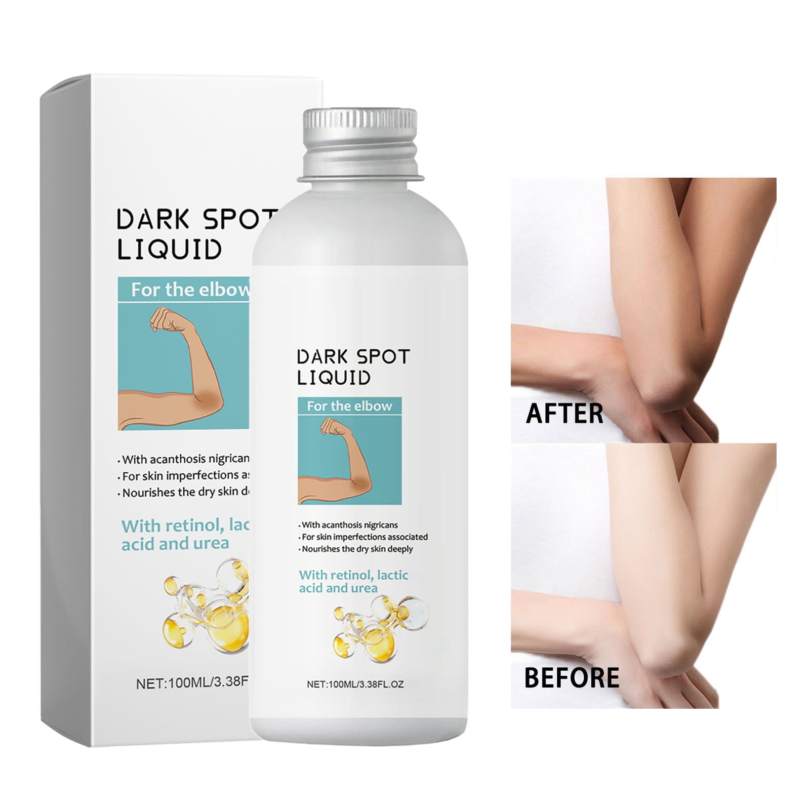 Elbow Lotion Lightens Joint Dullness Nourishes And Skin To An Even And ...