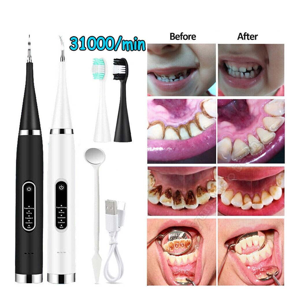 Electric Sonic Dental Scaler Tartar Plaque Calculus Remover Teeth ...