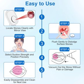 Oral Suction Device