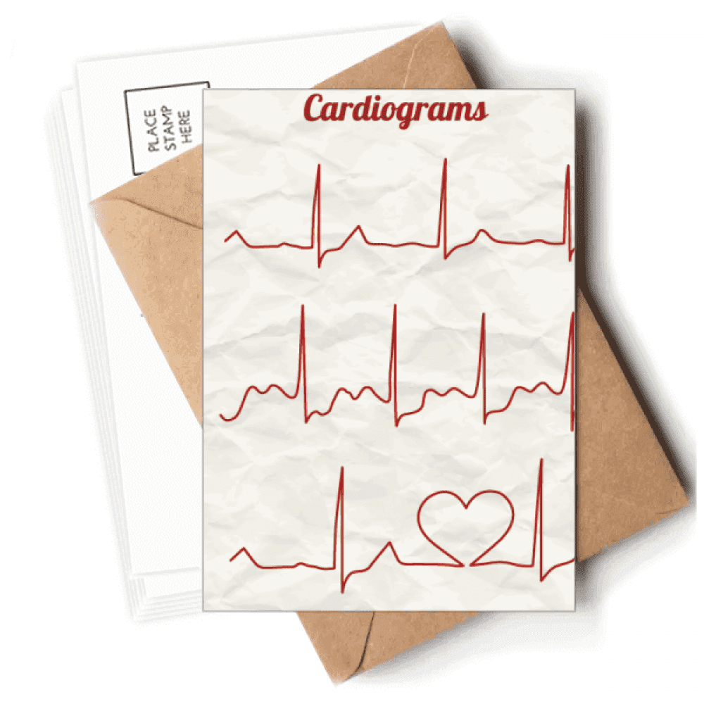 Electrocardiogram Heart Design Postcards Envelopes Blank Note Cards ...