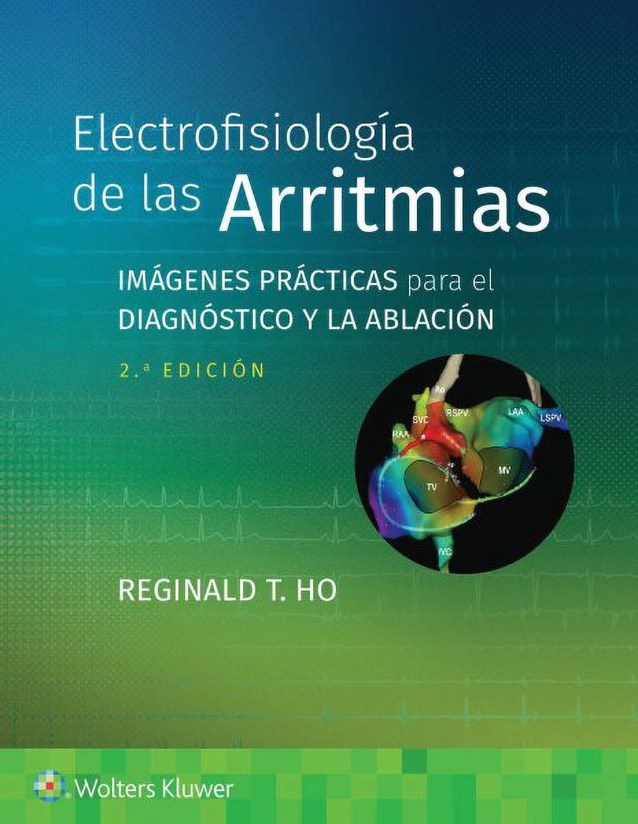 Electrofisiolog?a De Las Arritmias: Im?genes Pr?cticas Para El Diagn?stico Y La Ablaci?n ...