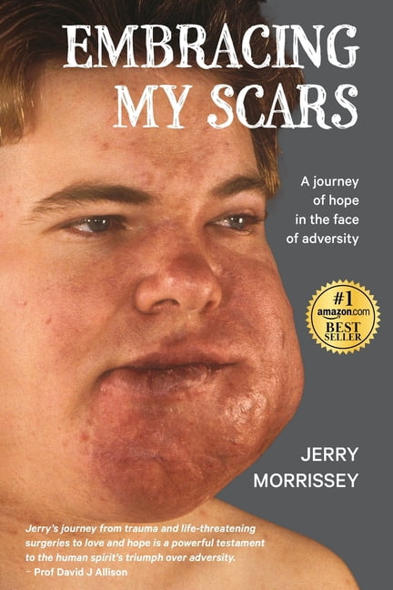 Embracing My Scars: A journey of hope in the face of adversity ...