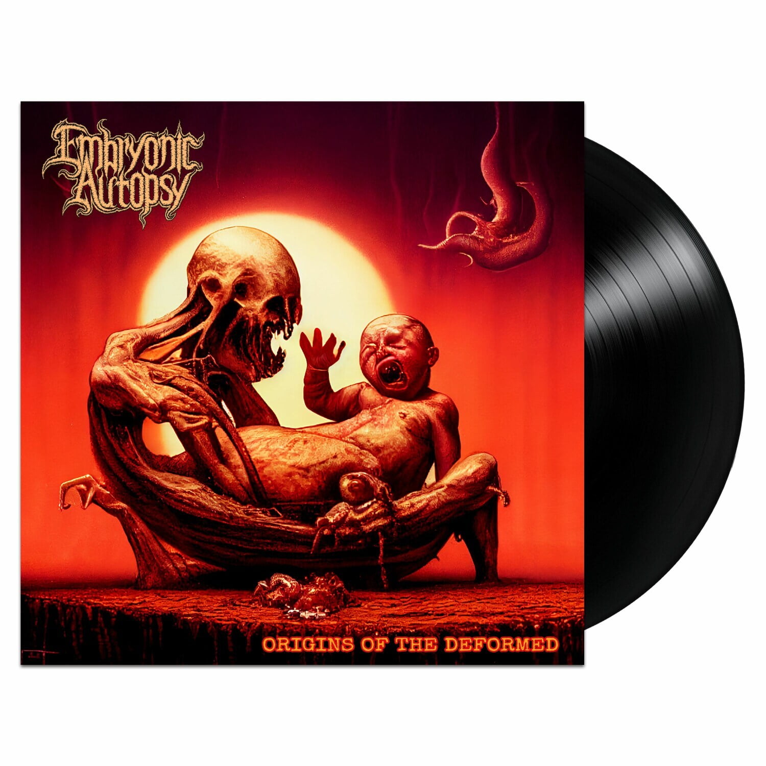 Embryonic Autopsy - Origins Of The Deformed - Music & Performance ...