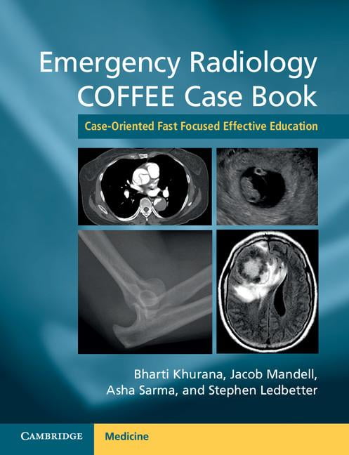 Emergency Radiology Coffee Case Book: Case-Oriented Fast Focused ...
