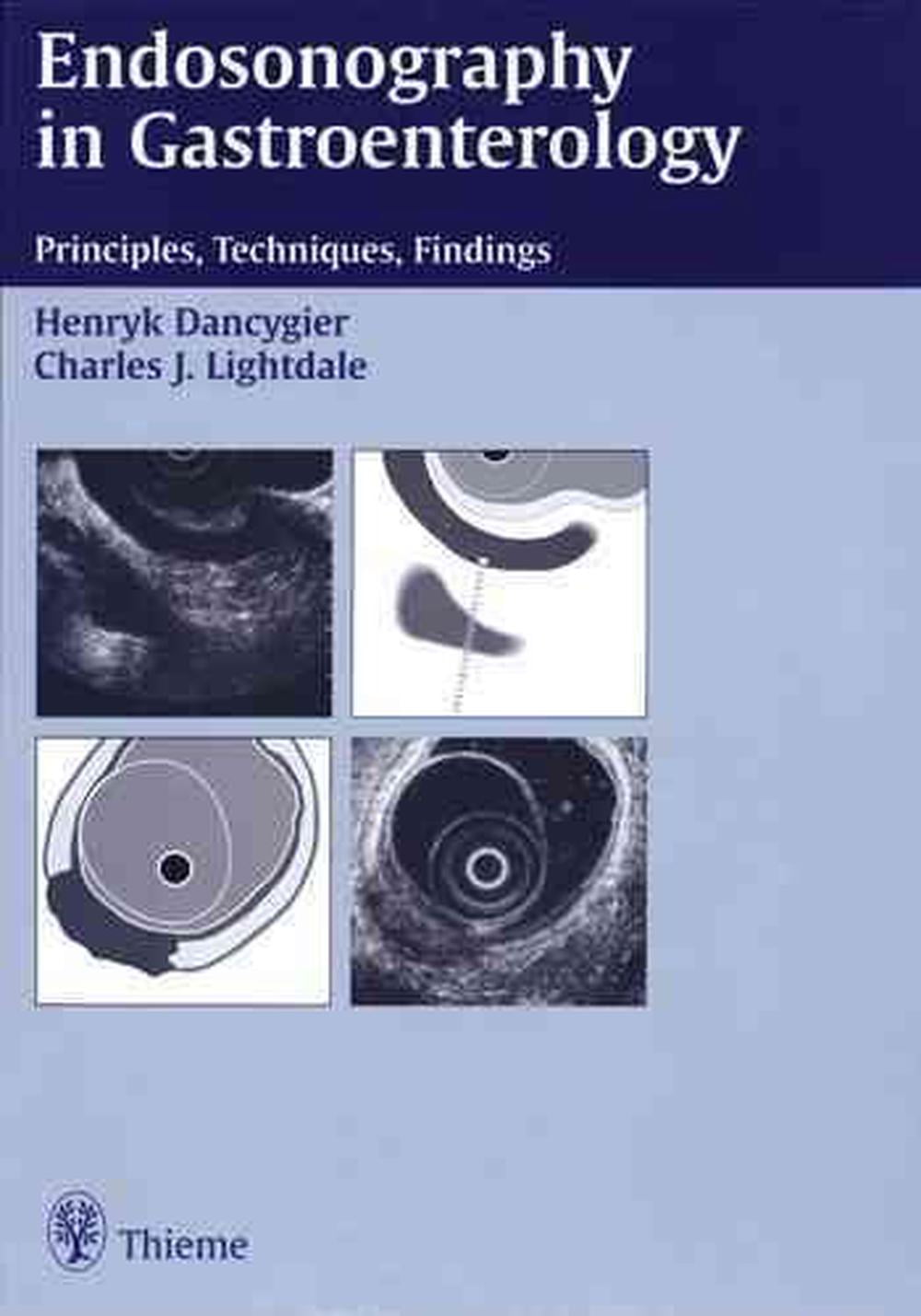 Endosonography in Gastroenterology: Principles, Techniques, Findings ...