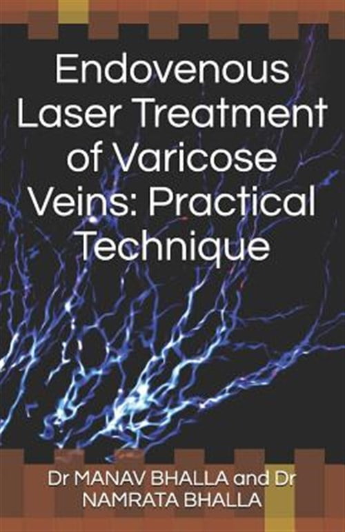 Endovenous Laser Treatment of Varicose Veins: Practical Technique (Paperback) by Namrata Bhalla ...