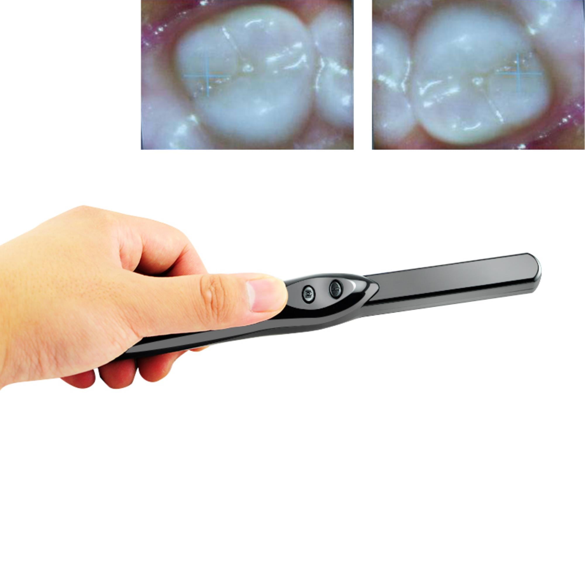 Enhance Dentistry with Dental Intraoral Camera - High-Resolution 6MP, 6 ...