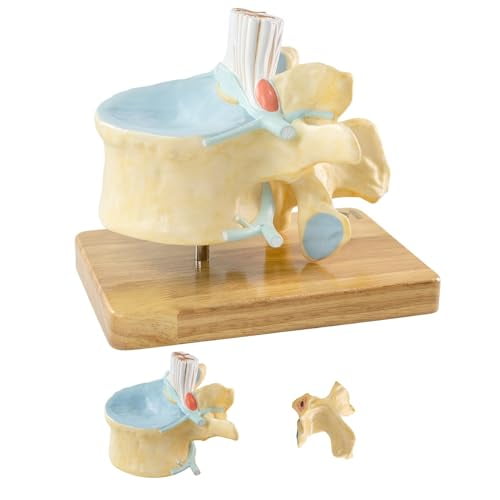 Enlarged Human Lumbar Vertebra Model with Spinal Cord & Cauda Equina ...