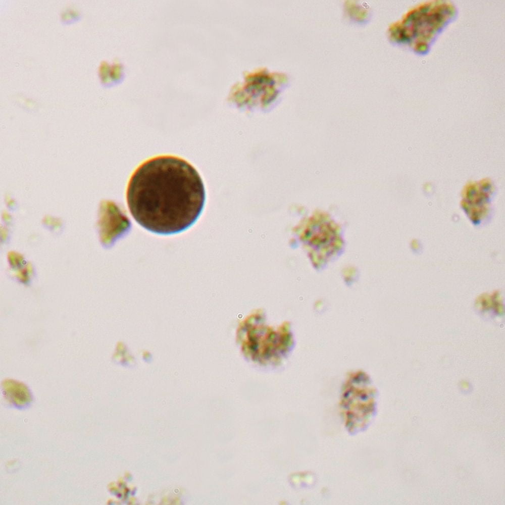 Entamoeba Coli Cysts And Trophozoites