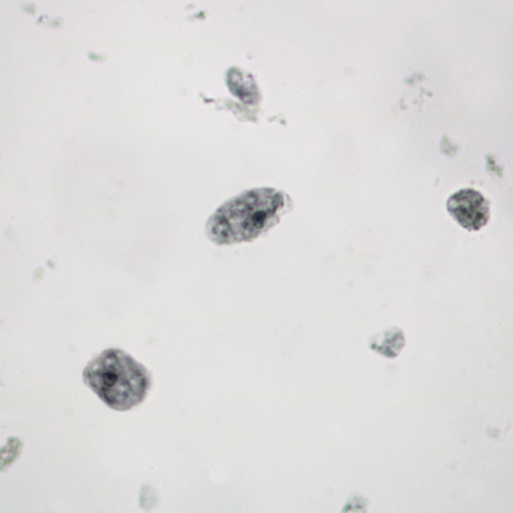 Entamoeba Histolytica