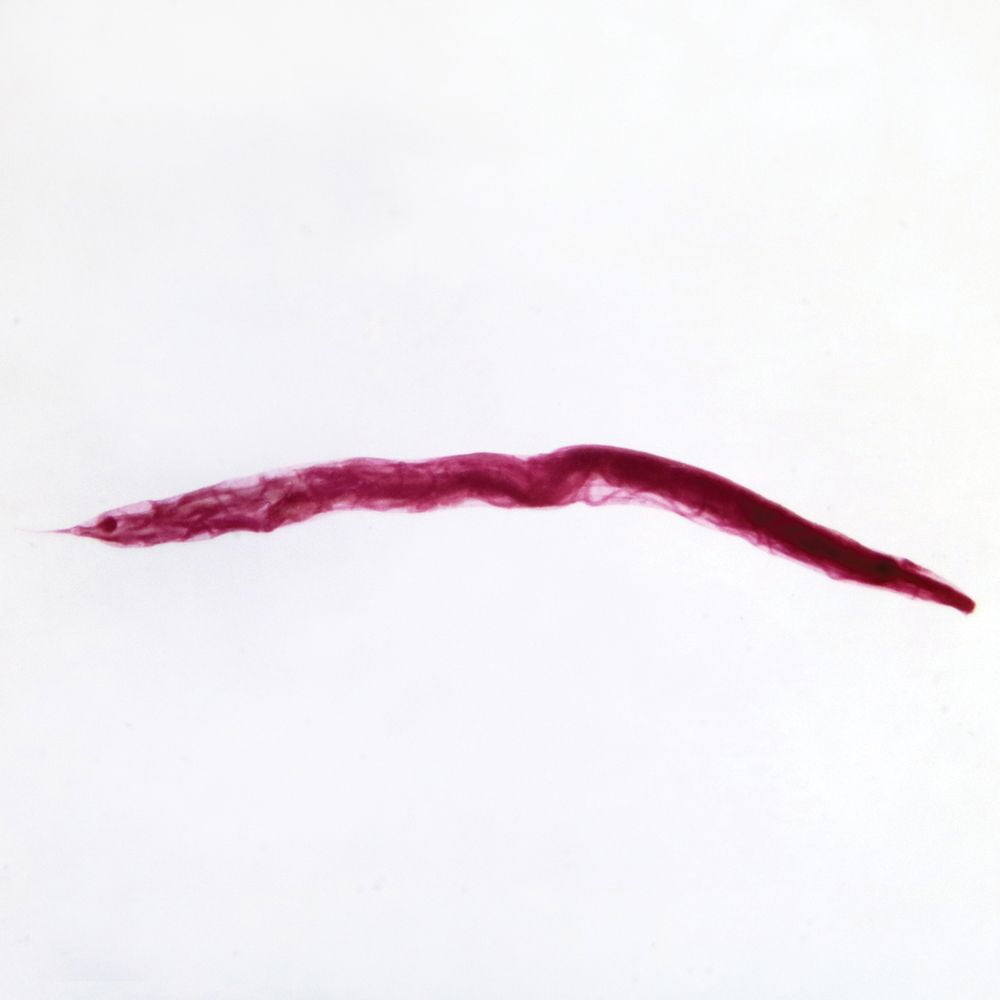 Enterobius Vermicularis Slide