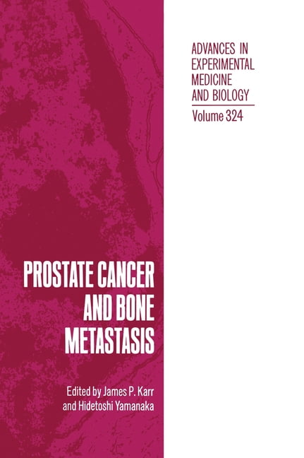 Environmental Science Research Prostate Cancer and Bone Metastasis ...
