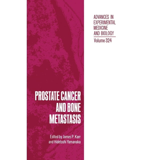 Environmental Science Research Prostate Cancer and Bone Metastasis ...