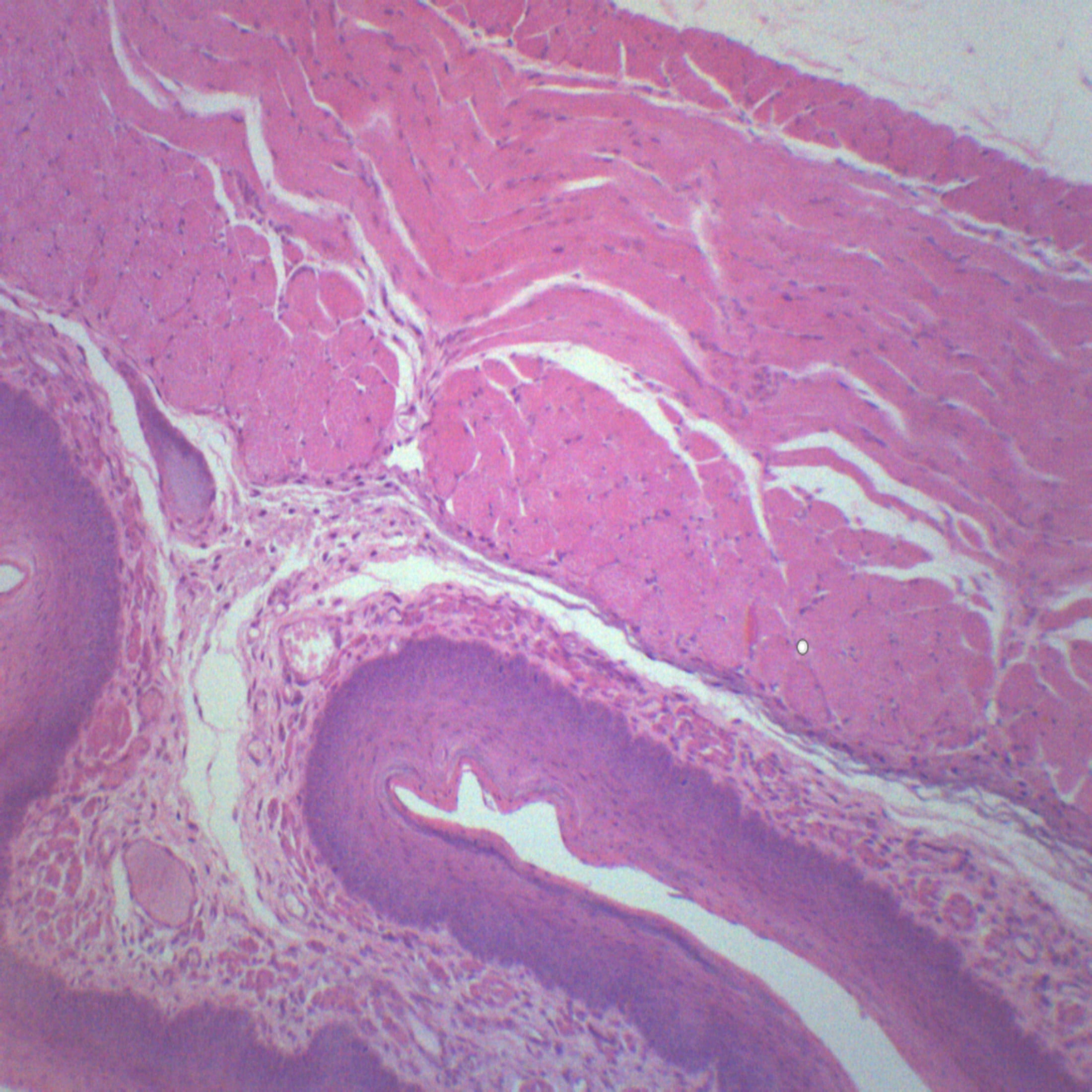 Esophagus Epithelium, Cross Section - Prepared Microscope Slide - 75 x ...