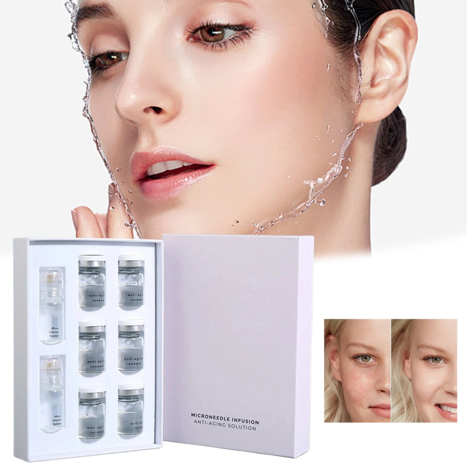 Essence YOOJ Microneedle Microinfusion System YOOJ Skin Tightening ...