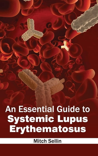 Essential Guide to Systemic Lupus Erythematosus, (Hardcover) - Walmart.com