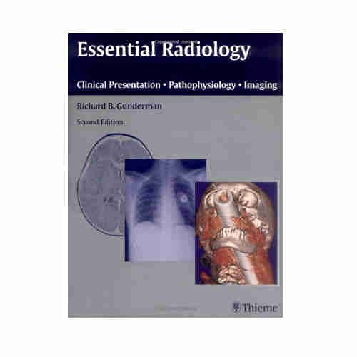 Essential Radiology: Clinical Presentation, Pathophysiology, Imaging ...