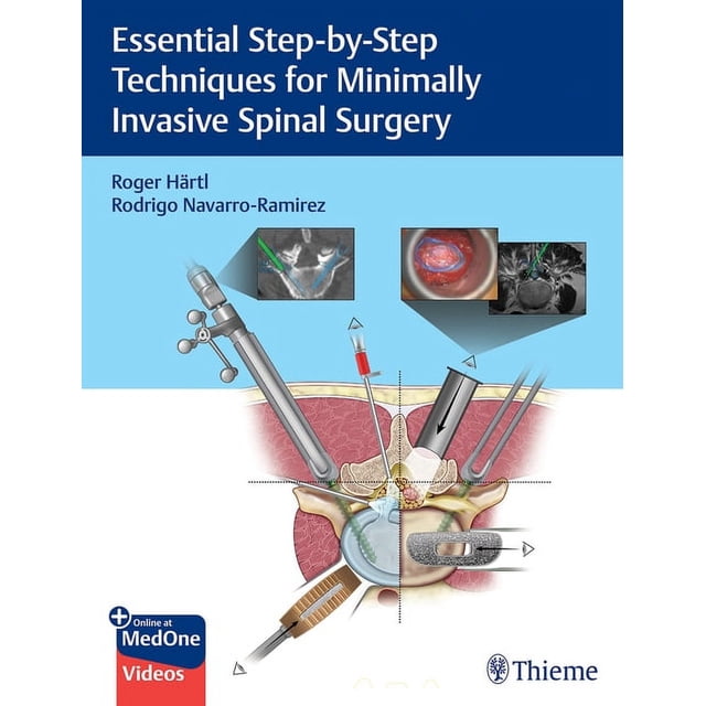 Essential Step-By-Step Techniques for Minimally Invasive Spinal Surgery ...