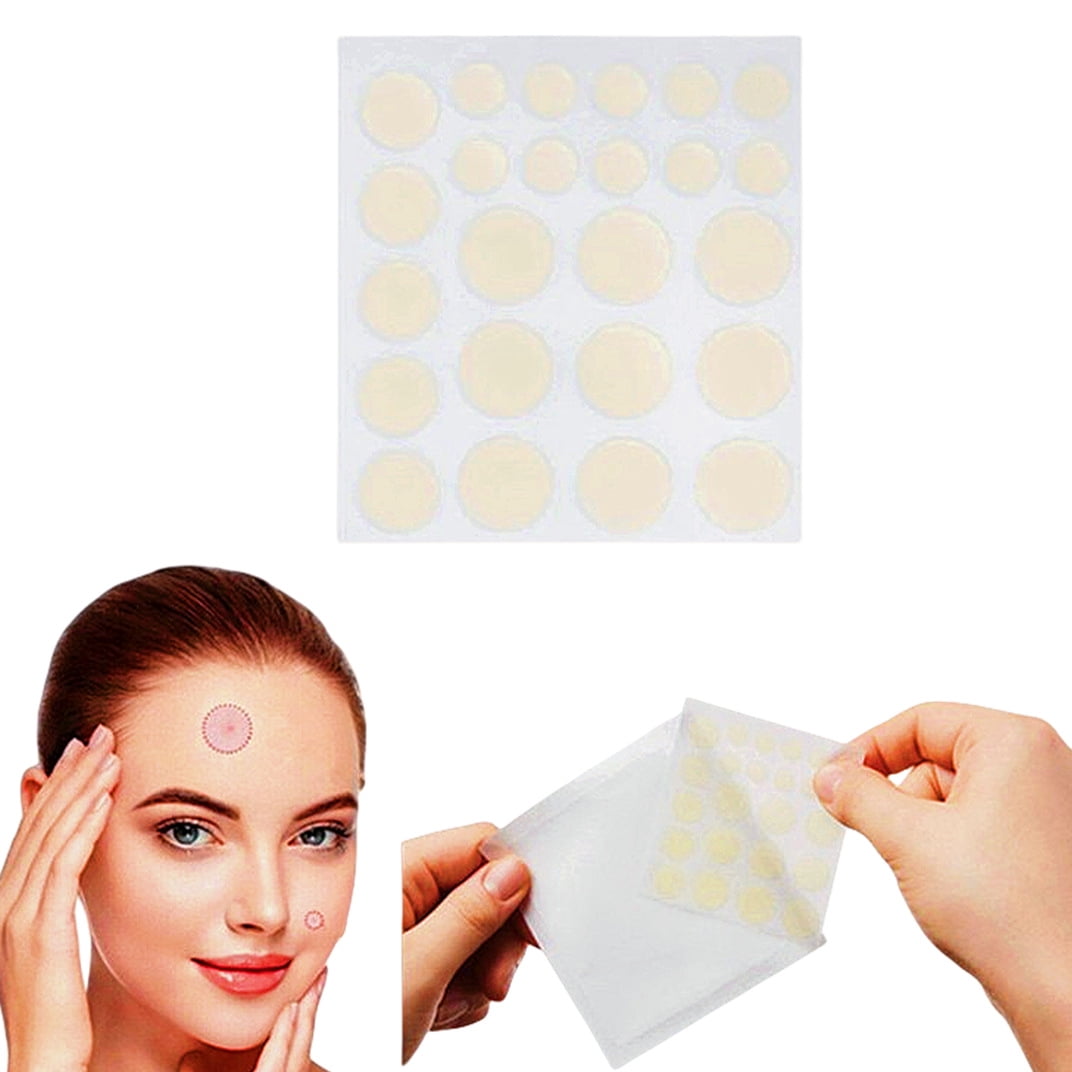 Essential oil acne paste colloid acne paste invisible waterproof ...