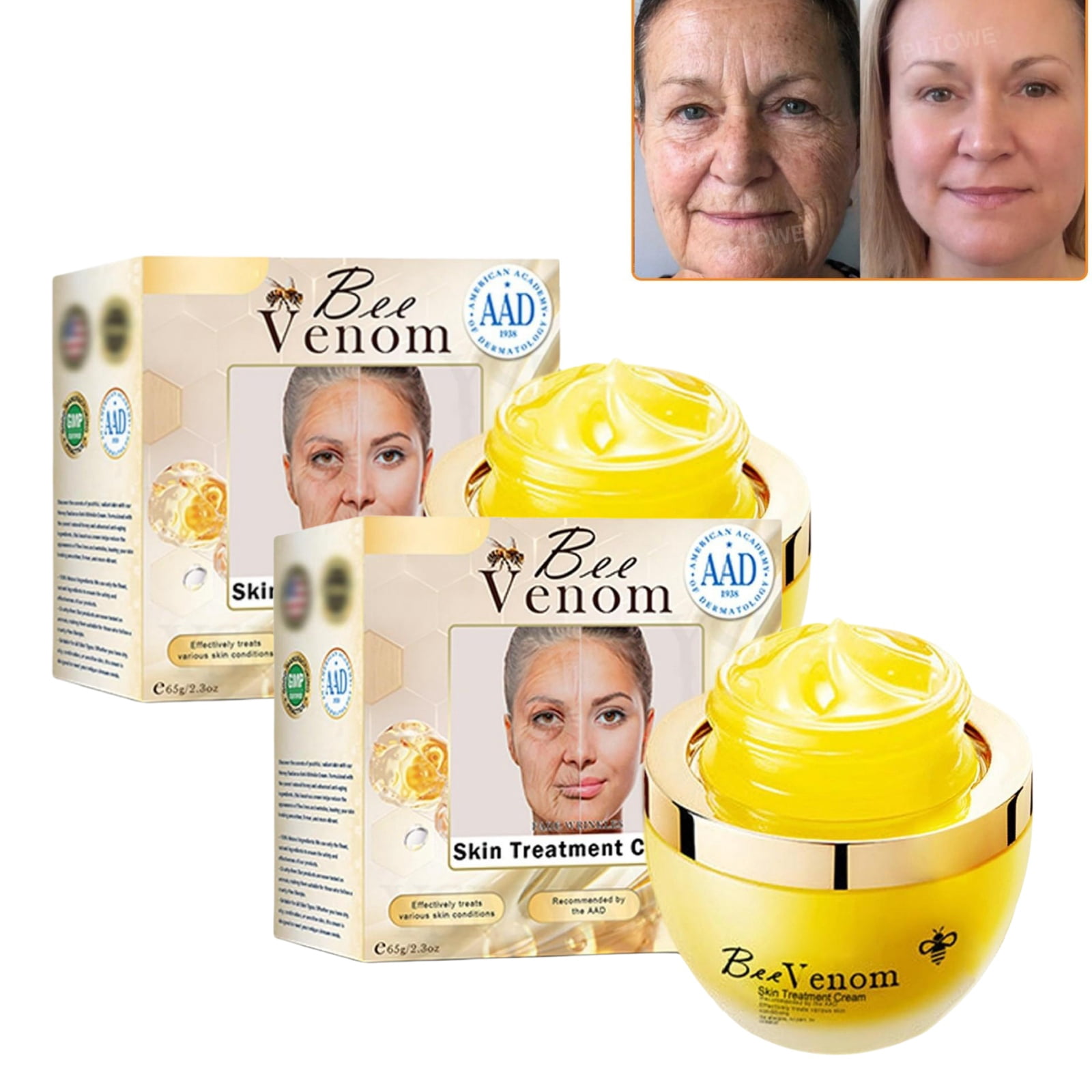 Euamux Be®e Ven®om Skin Cream, 2025 New Be®e Ven®om for skin,Be®e Ven ...