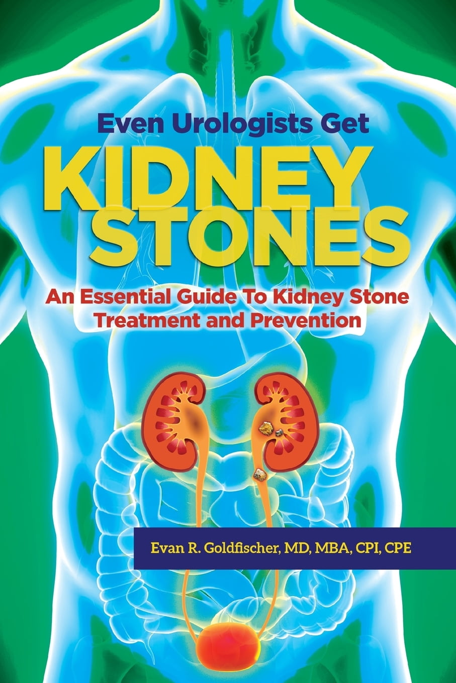 Even Urologists Get Kidney Stones: An Essential Guide to Kidney Stone ...